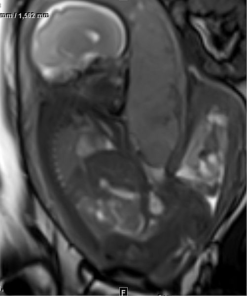 Klinikum Karlsruhe: Kinderradiologie